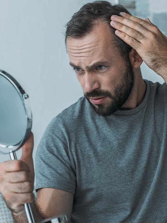 O segredo para cuidar da calvíce